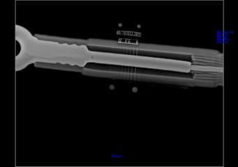 Digital Radiography (DR) System Portable X-ray Machine for Welding ...