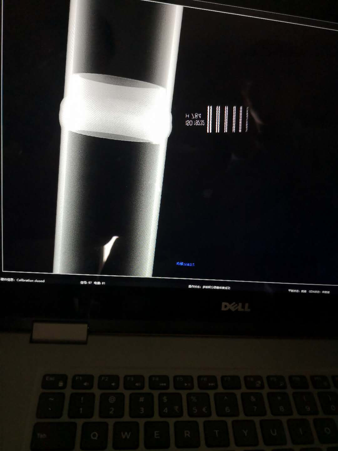 Digital Radiography (DR) System Portable X-ray Machine for Welding ...